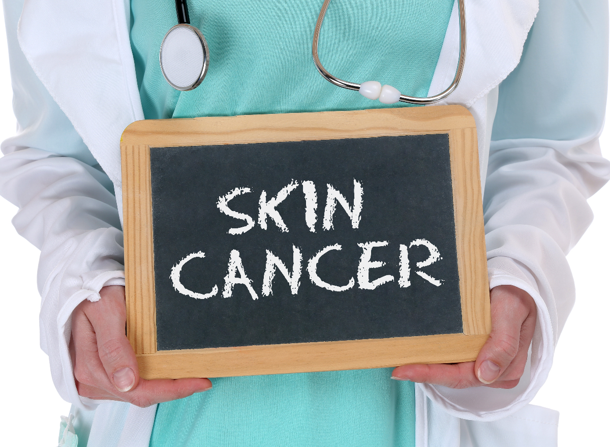 Subtle Red Flags That Could Point To Skin Cancer, Expert Says — Eat ...
