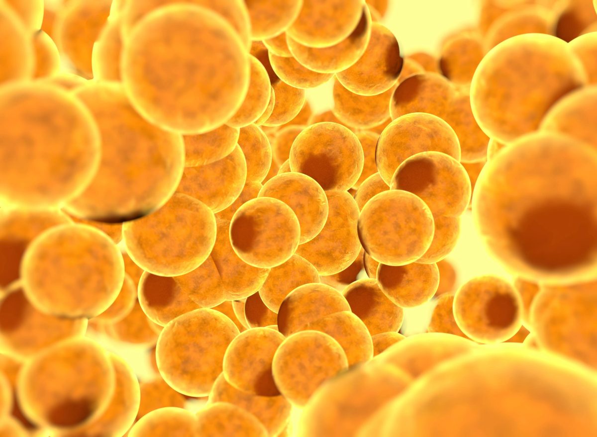 'Skinny' Fat Cells May Be Why You're Gaining Weight